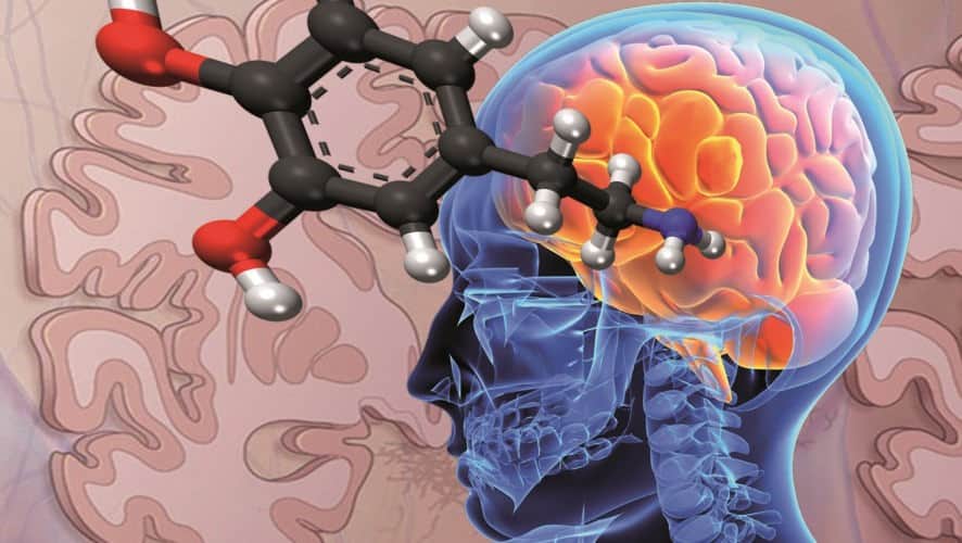 Parkinson, síntomas, diagnóstico y evolución - Mundo Entrenamiento