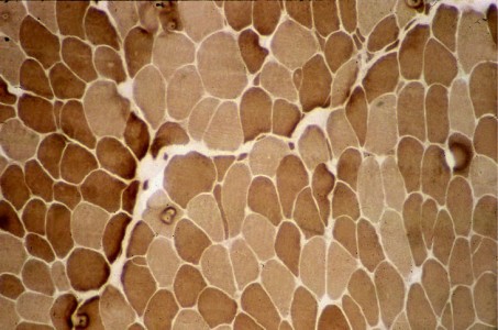 3 Tipos de fibras musculares | Mundo Entrenamiento