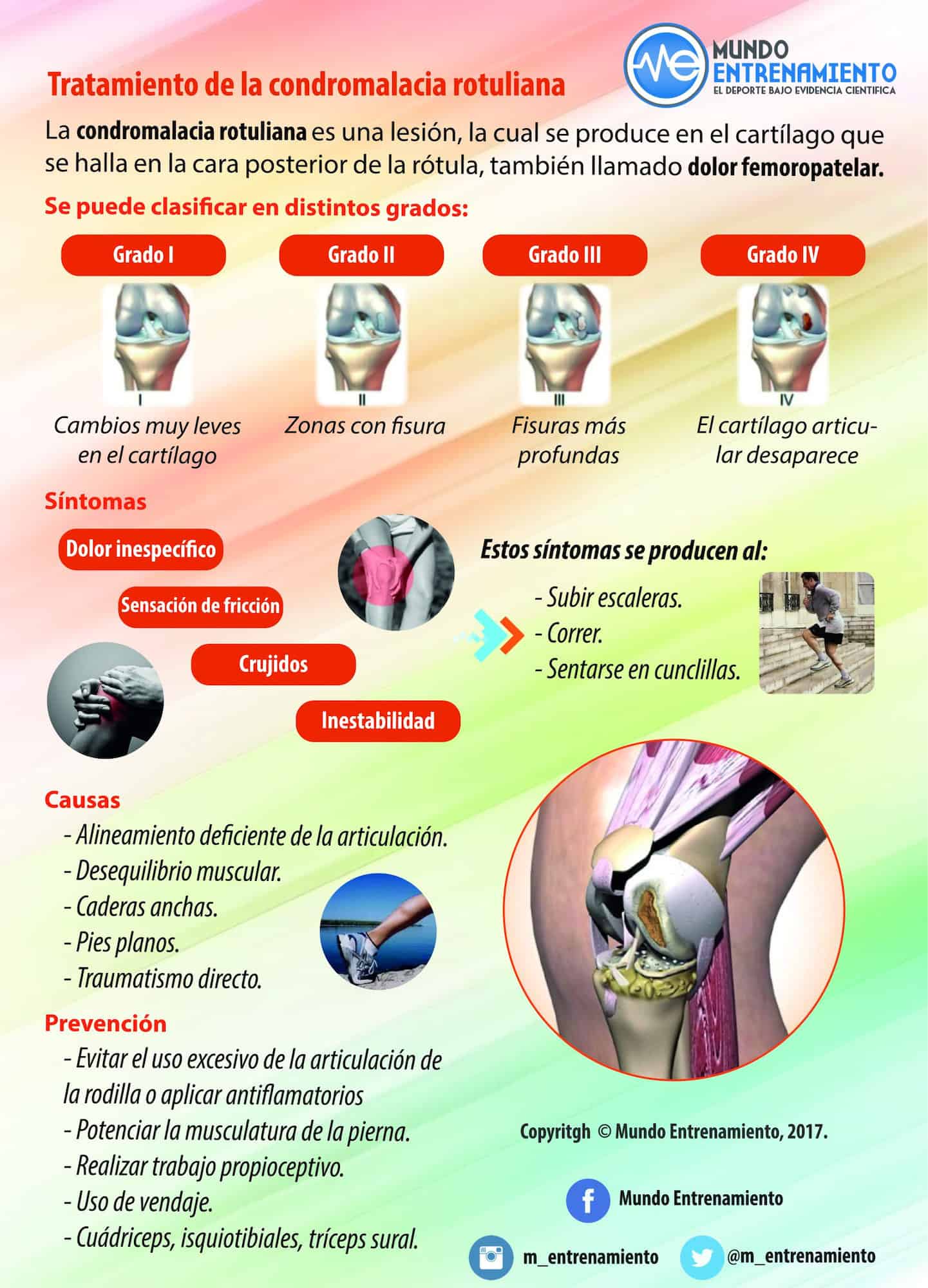 Condromalacia rotuliana, 1 propuesta práctica en interior