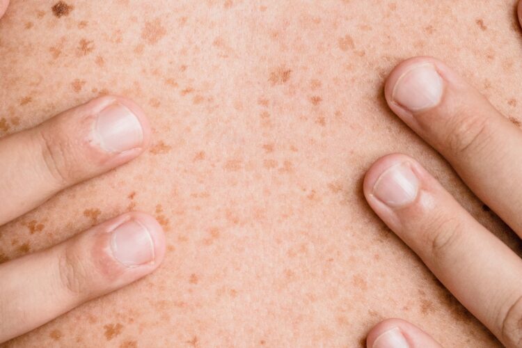 5 enfermedades de la piel: origen. síntomas, tratamientos