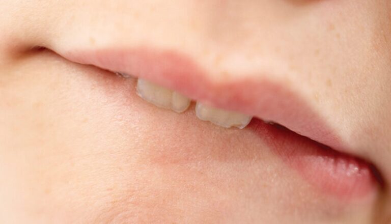 Deglución atípica: 3 tipos, efectos y terapias miofaciales