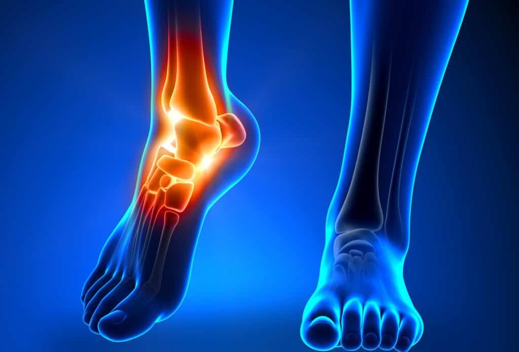 Common Talus Foot Injuries: Causes and Symptoms